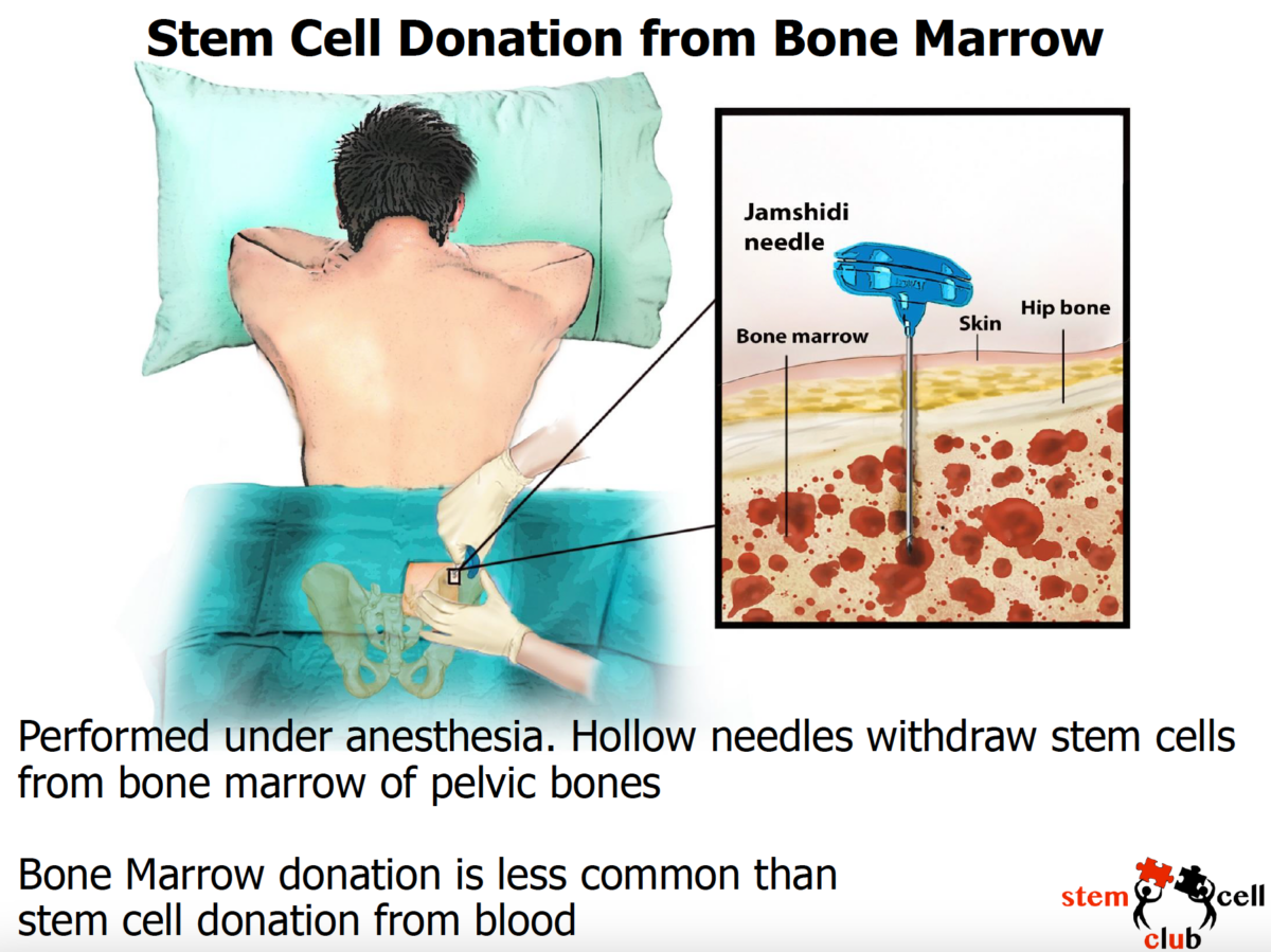 Asian Heritage Month: Raising awareness on Asian stem cell donors with the Stem Cell Club ...